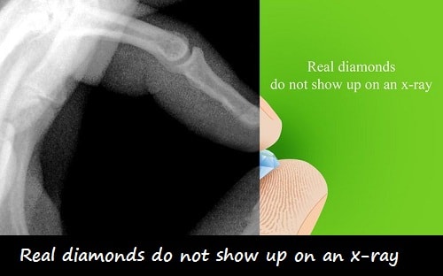 Real diamonds do not show up on an x-ray